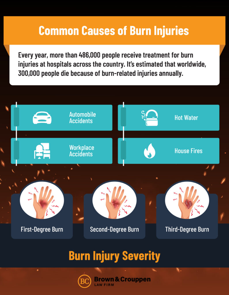 St. Louis, MO Burn Injury Lawyer - Brown & Crouppen